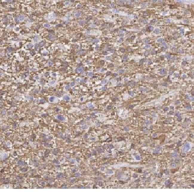 FBXO6 Antibody - BSA Free, Novus Biologicals 100 μg; Unconjugated ...