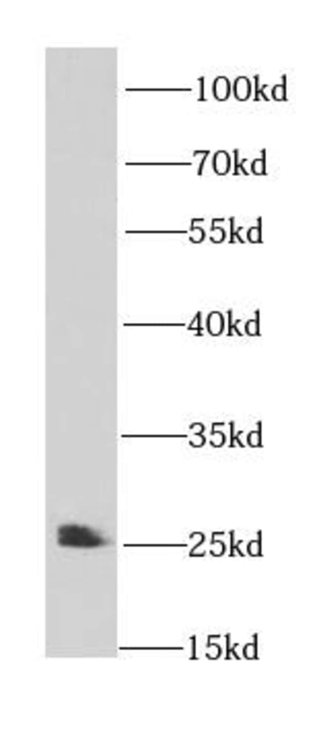 HspB11 Antibody - BSA Free, Novus Biologicals 100 μg; Unconjugated ...