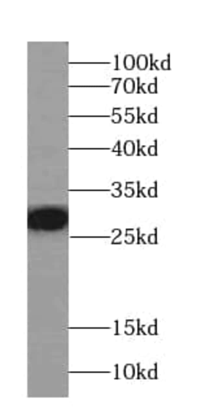 Factor XII heavy chain Antibody (4E7) - BSA Free, Novus Biologicals 100 ...