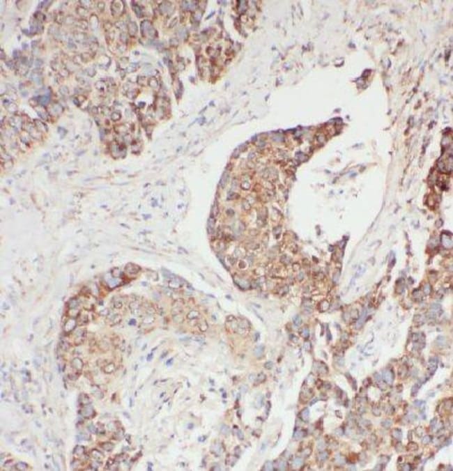 EDC4 Antibody - BSA Free, Novus Biologicals 100 μg; Unconjugated ...
