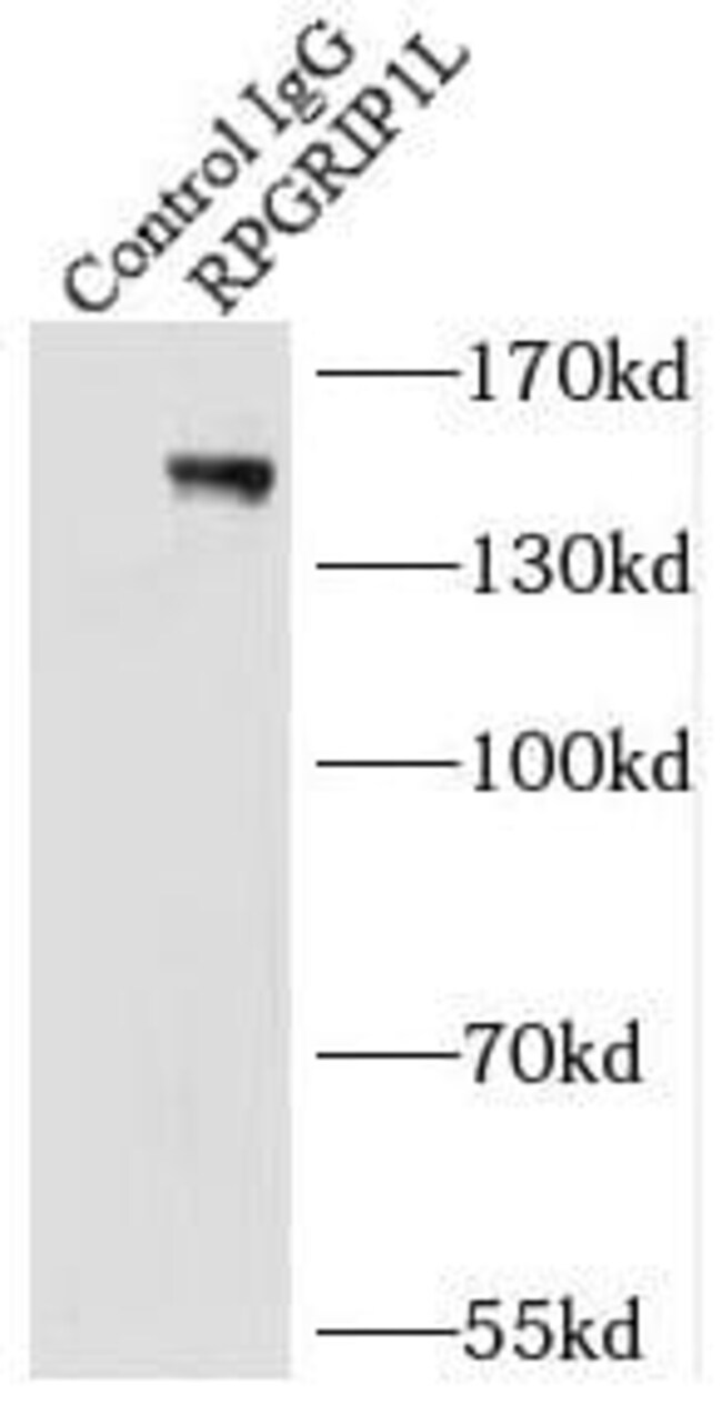 RPGRIP1L Antibody - BSA Free, Novus Biologicals 100 μg; Unconjugated ...