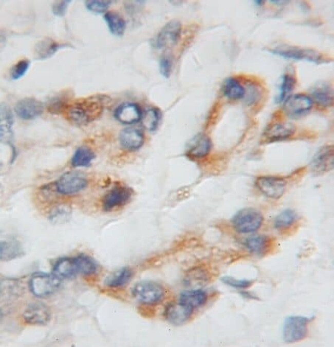 PTP4A1 Antibody - BSA Free, Novus Biologicals 100 μg; Unconjugated ...