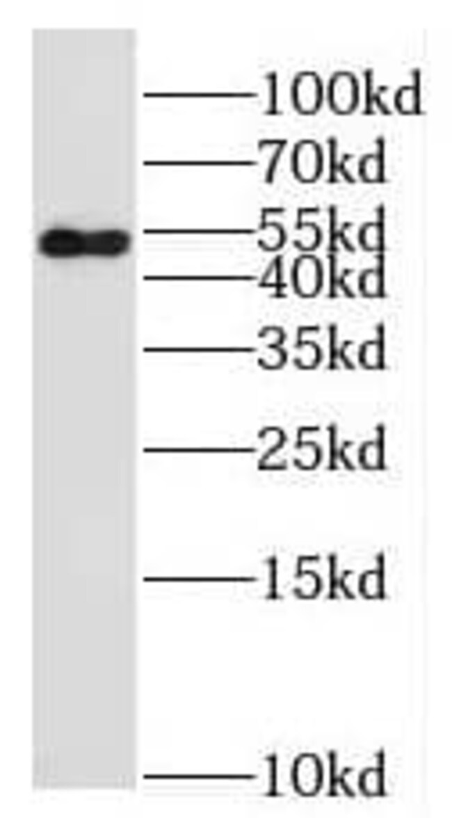 PTP4A1 Antibody - BSA Free, Novus Biologicals 100 μg; Unconjugated ...
