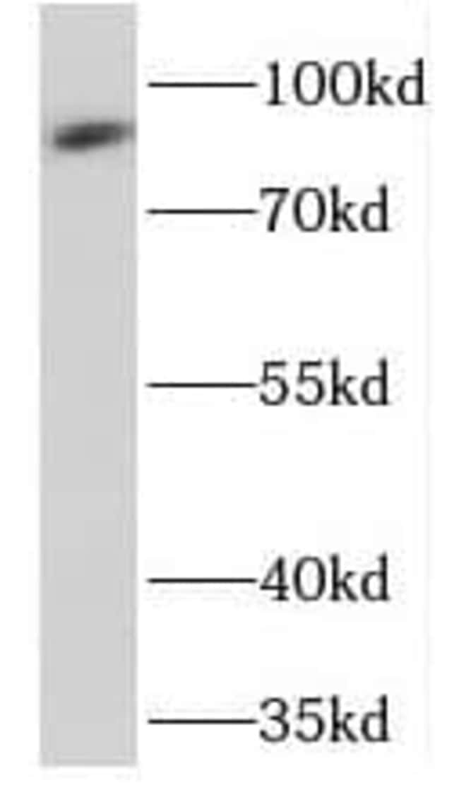 cGK2/PRKG2 Antibody - BSA Free, Novus Biologicals 100 μg; Unconjugated ...