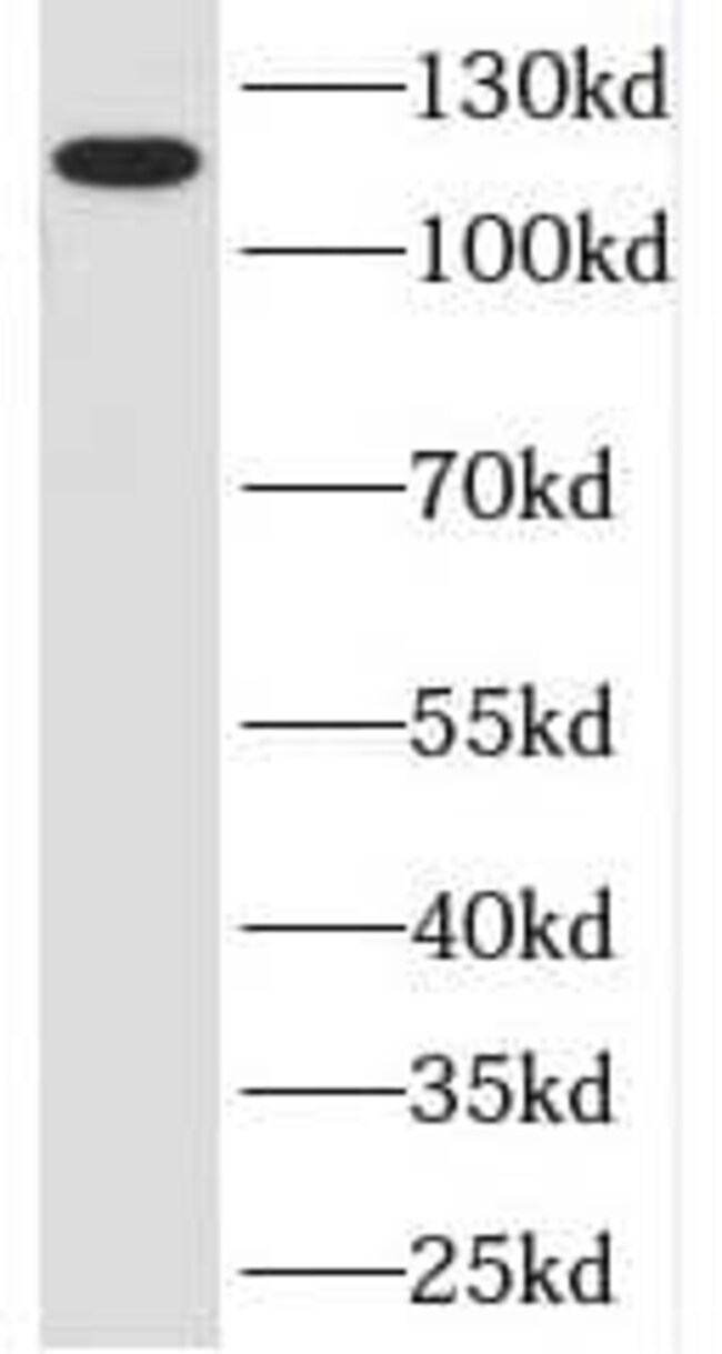 POP1 Antibody - BSA Free, Novus Biologicals 100 μg; Unconjugated ...