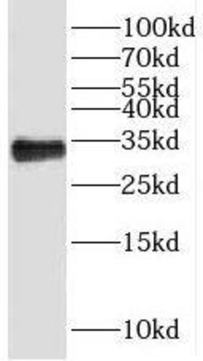 MMADHC Antibody - BSA Free, Novus Biologicals 100 μg; Unconjugated ...