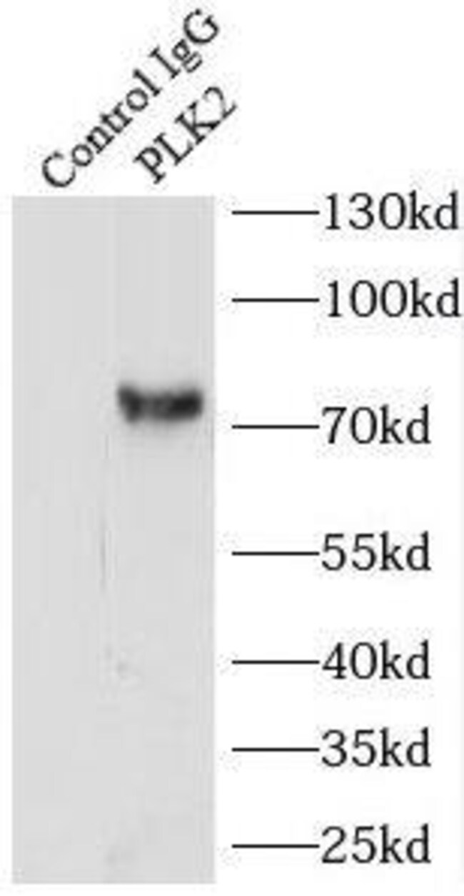 PLK2 Antibody - BSA Free, Novus Biologicals 100 μg; Unconjugated ...