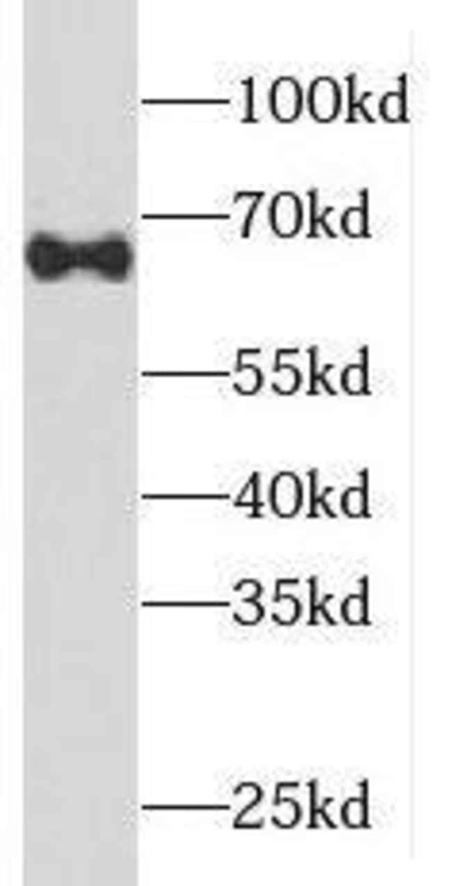PIGT Antibody - BSA Free, Novus Biologicals 100 μg; Unconjugated ...