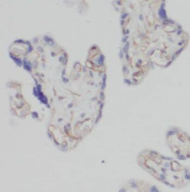 PDIR Antibody - BSA Free, Novus Biologicals 100 μg; Unconjugated ...