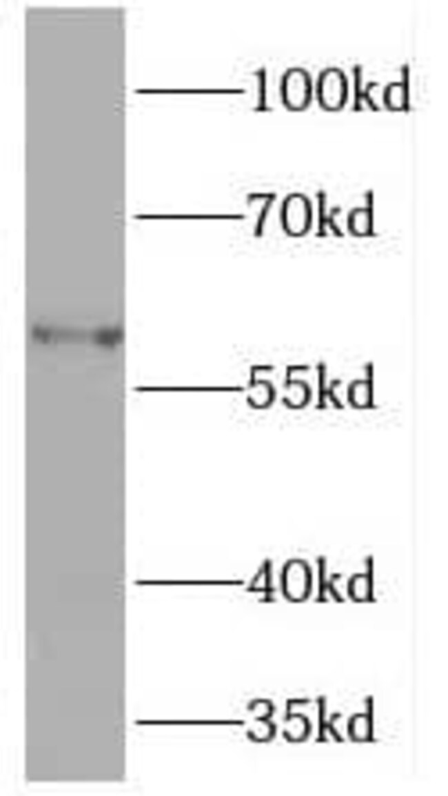 PDIR Antibody - BSA Free, Novus Biologicals 100 μg; Unconjugated ...