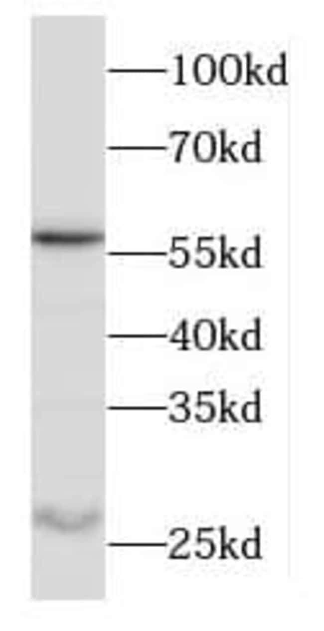 Odf1 Antibody - BSA Free, Novus Biologicals 100 μg; Unconjugated ...