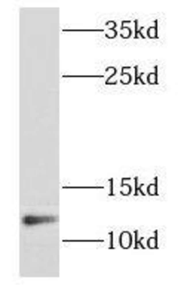 NDUFB2 Antibody - BSA Free, Novus Biologicals 100 μg; Unconjugated ...