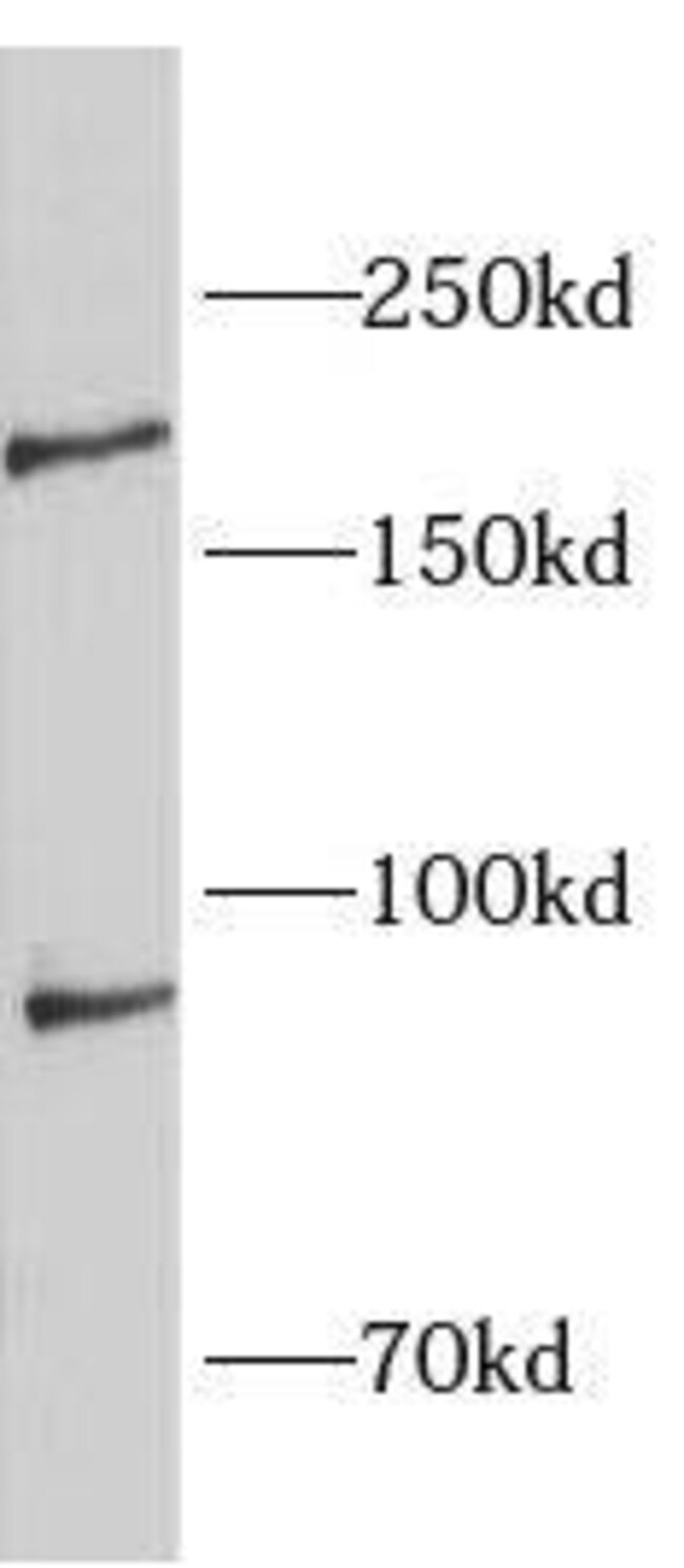 SLC4A10 Antibody - BSA Free, Novus Biologicals 100 μg; Unconjugated ...