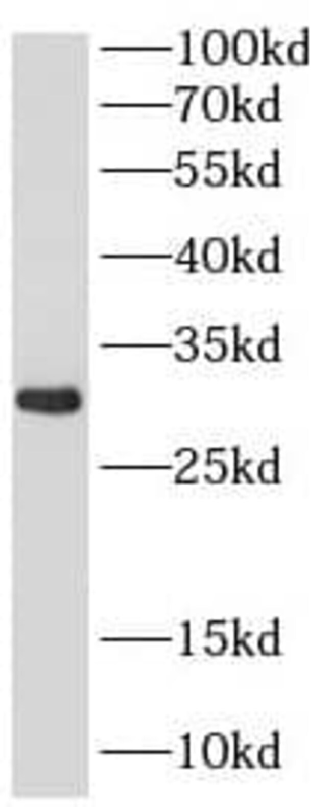 WBSCR27 Antibody - BSA Free, Novus Biologicals 100 μg; Unconjugated ...