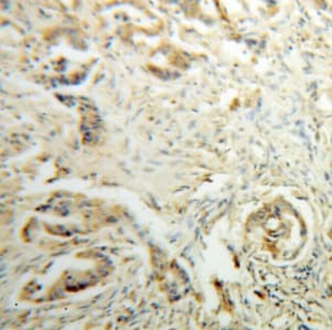 DHDH Antibody - BSA Free, Novus Biologicals 100 μg; Unconjugated ...