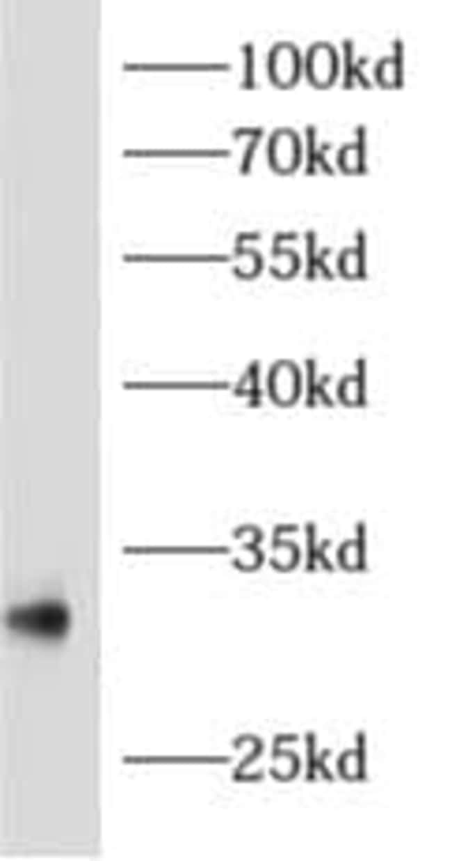 archaemetzincin-1 Antibody - BSA Free, Novus Biologicals 100 μg ...