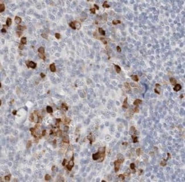 AKNA Antibody - BSA Free, Novus Biologicals 100 μg; Unconjugated ...