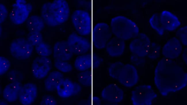 Abnova 19q13 (Orange) FISH Probe 19q13 (Orange) FISH Probe:Biochemical ...