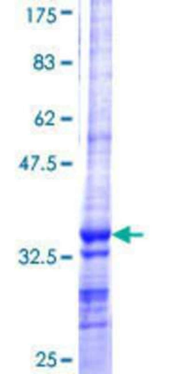 Novus Biologicals™ Recombinant Human Salivary Amylase Alpha GST (N-Term ... Novus Biologicals™ Recombinant Human Salivary Amylase Alpha GST (N-Term ...