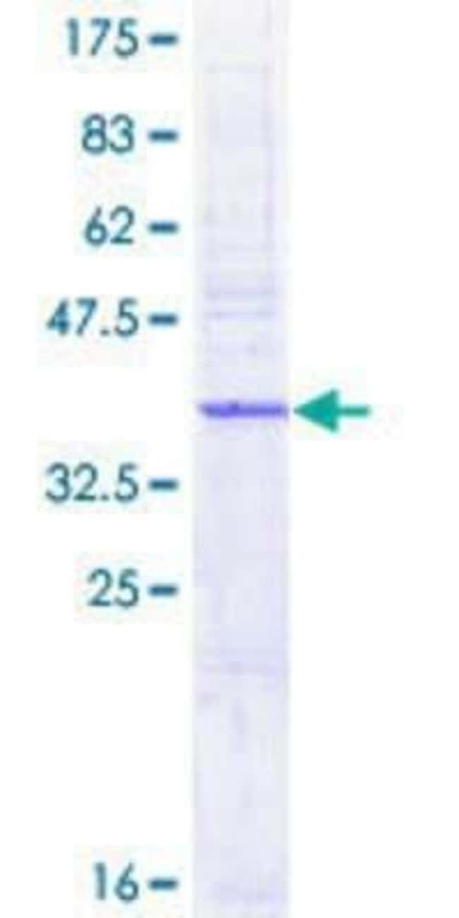 Novus Biologicals Recombinant Human AP1S1 GST (N-Term) Protein 10 μg ...