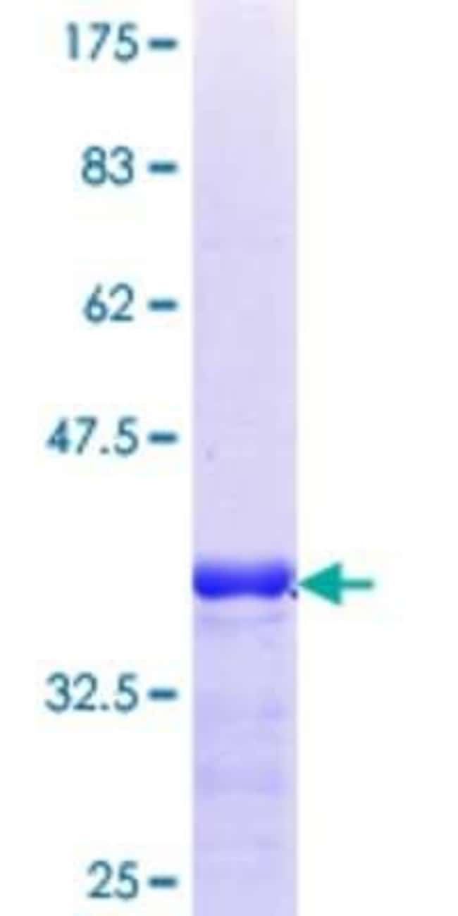 Novus Biologicals Recombinant Human CRY2 GST (N-Term) Protein 10 μg ...