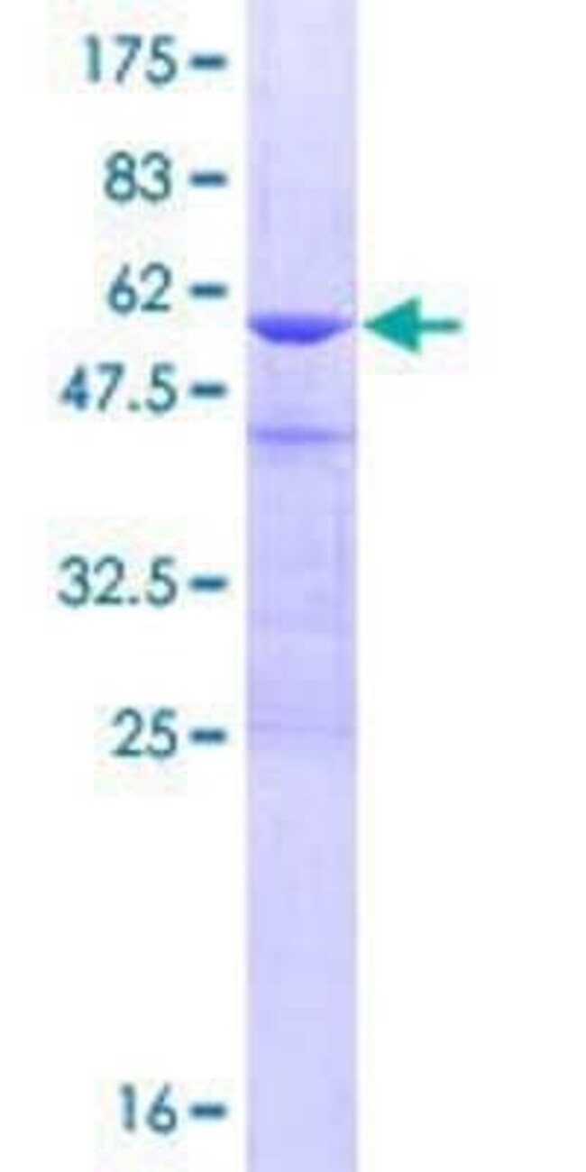 Novus Biologicals™ Recombinant Human CRYBB3 GST (N-Term) Protein 10 μg ...
