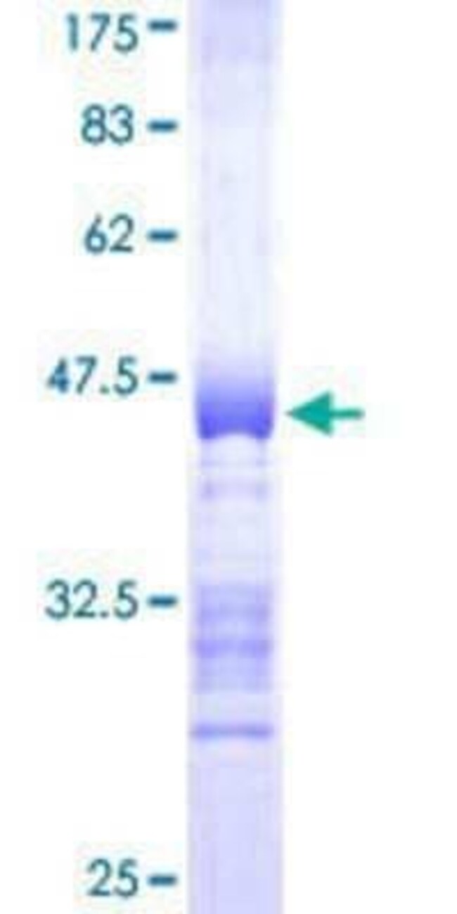 Novus Biologicals Recombinant Human delta 2 Catenin GST (N-Term ...