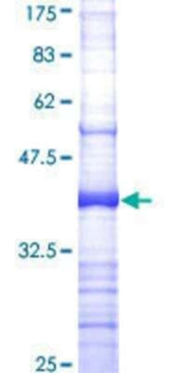 Novus Biologicals Recombinant Human Factor XII heavy chain GST (N-Term ...