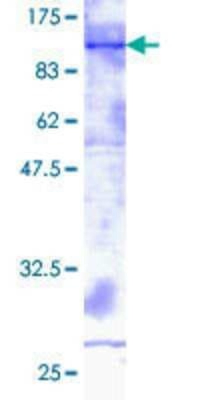Novus Biologicals™ Recombinant Human ADAM2 GST (N-Term) Protein 2 μg ...