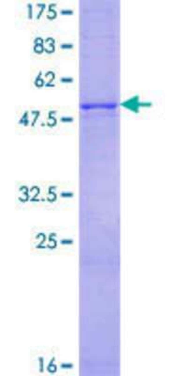 Novus Biologicals Recombinant Human Connexin 31/GJB3 GST (N-Term ...