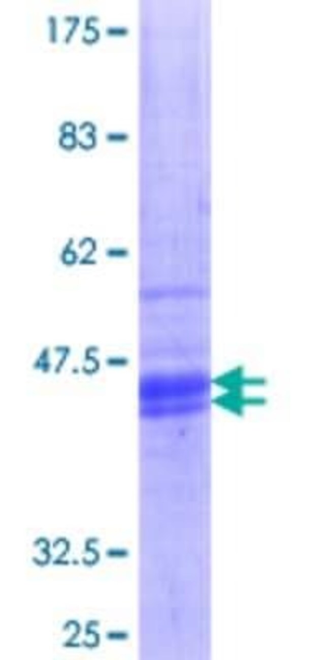 Novus Biologicals™ Recombinant Human Histamine H1R GST (N-Term) Protein ...