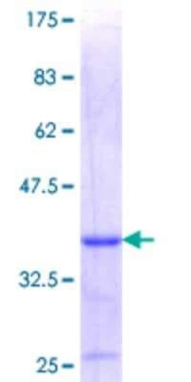 Novus Biologicals Recombinant Human PINCH1/LIMS1 GST (N-Term) Protein ...