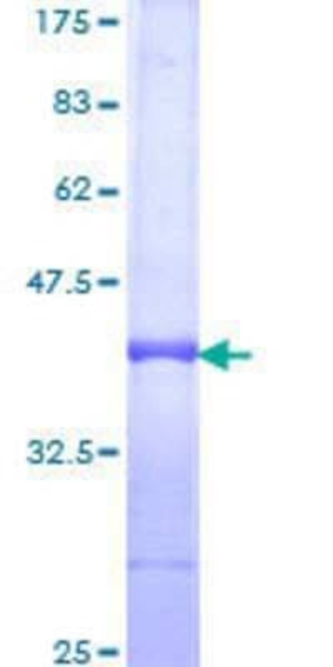 Novus Biologicals Recombinant Human PI 3-Kinase p110 delta GST (N-Term ...