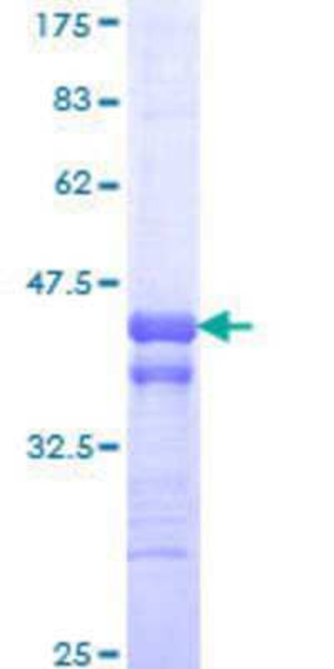 Novus Biologicals Recombinant Human ROR beta GST (N-Term) Protein 10 μg ...