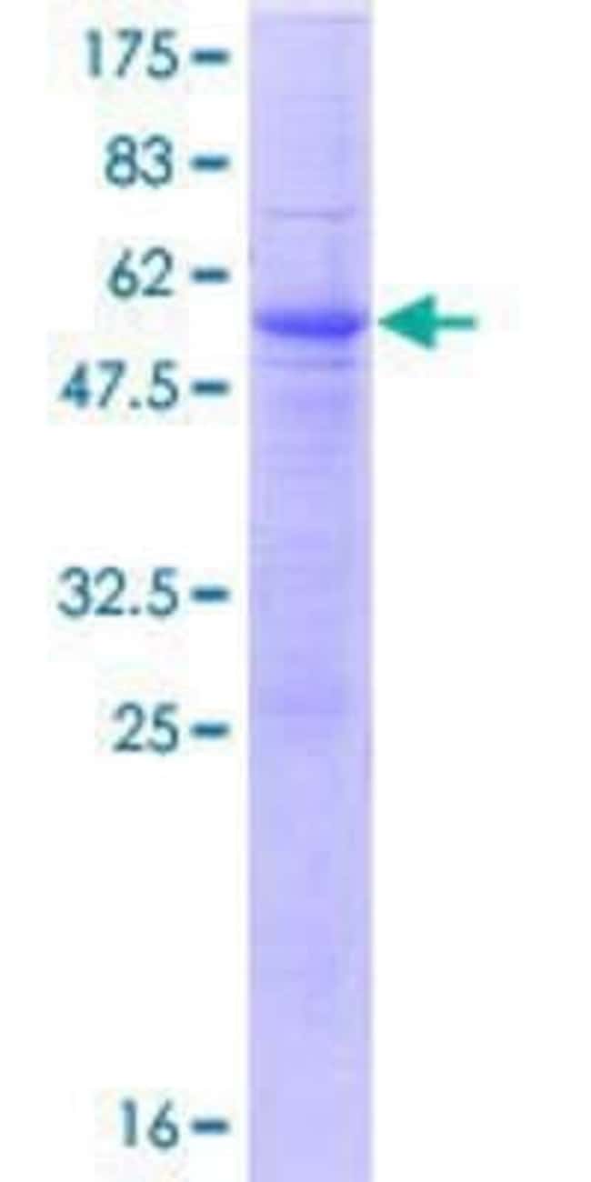 Novus Biologicals Recombinant Human TCR alpha GST (N-Term) Protein 25 ...