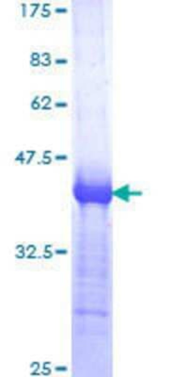 Novus Biologicals™ Recombinant Human TRAF-3 GST (N-Term) Protein 10 μg ...