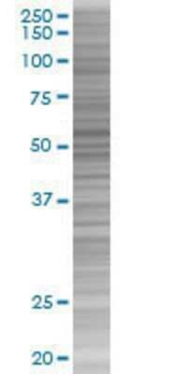 Novus Biologicals™ Thioredoxin Reductase 1/TRXR1 293T Cell Transient ...