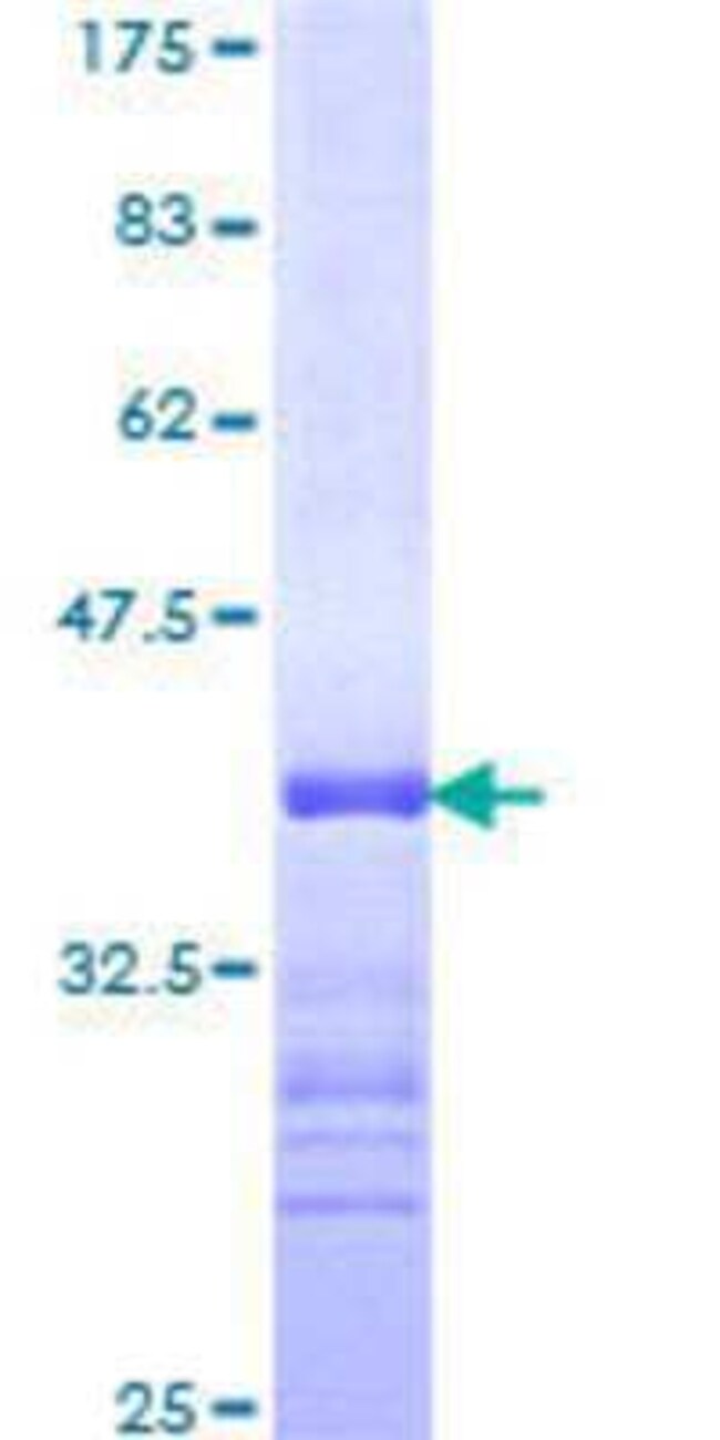 Novus Biologicals Recombinant Human ARID1A GST (N-Term) Protein 10 μg ...