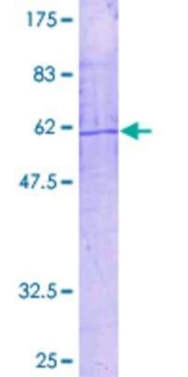 Novus Biologicals™ Recombinant Human PLA2G4B GST (N-Term) Protein 25 μg ...