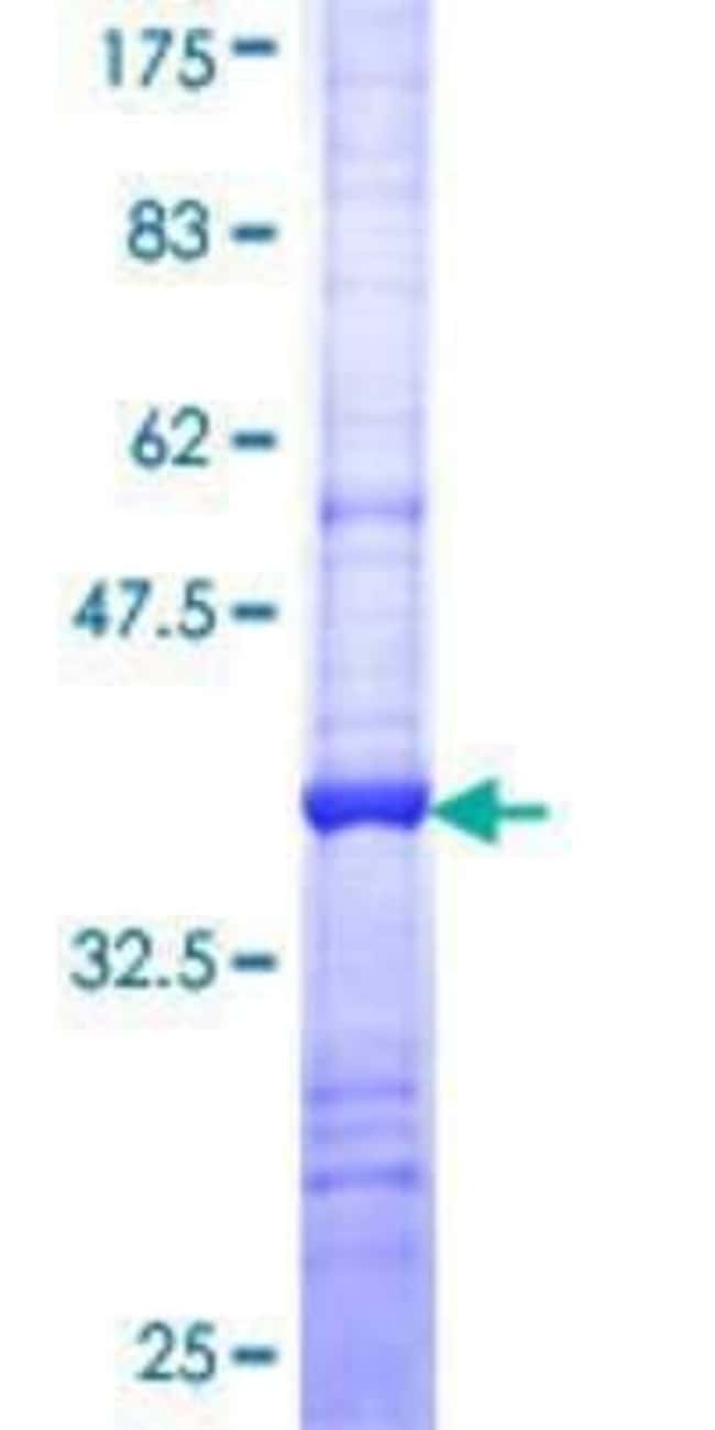 Novus Biologicals Recombinant Human GlyT2/SLC6A5 GST (N-Term) Protein ...