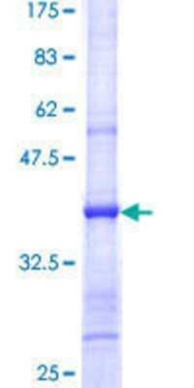 Novus Biologicals Recombinant Human EIF4E2 GST (N-Term) Protein 10 μg ...