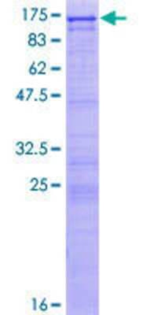 Novus Biologicals™ Recombinant Human UTP14A GST (N-Term) Protein 25 μg ...