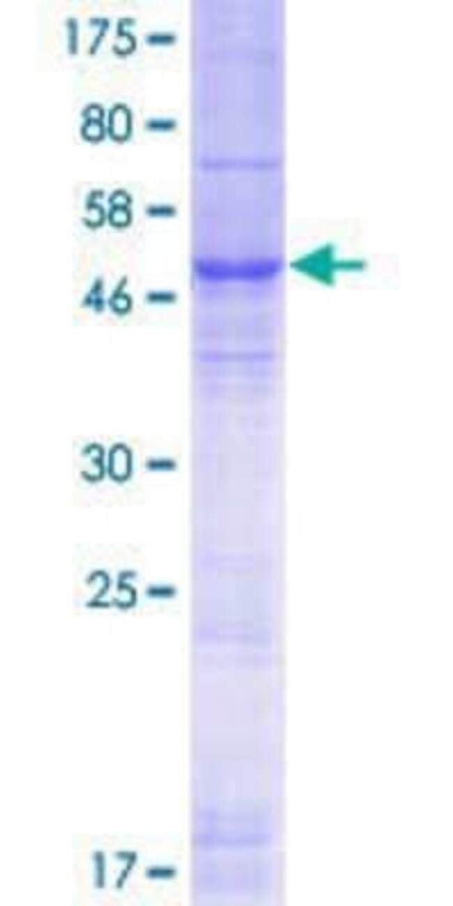 Novus Biologicals™ Recombinant Human YIF1A GST (N-Term) Protein 10 μg ...