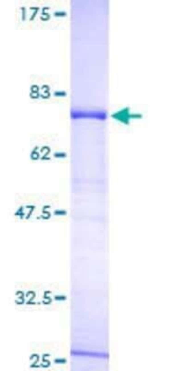 Novus Biologicals™ Recombinant Human Gtp Binding Protein Era Homolog Gst N Term Protein 10 μg