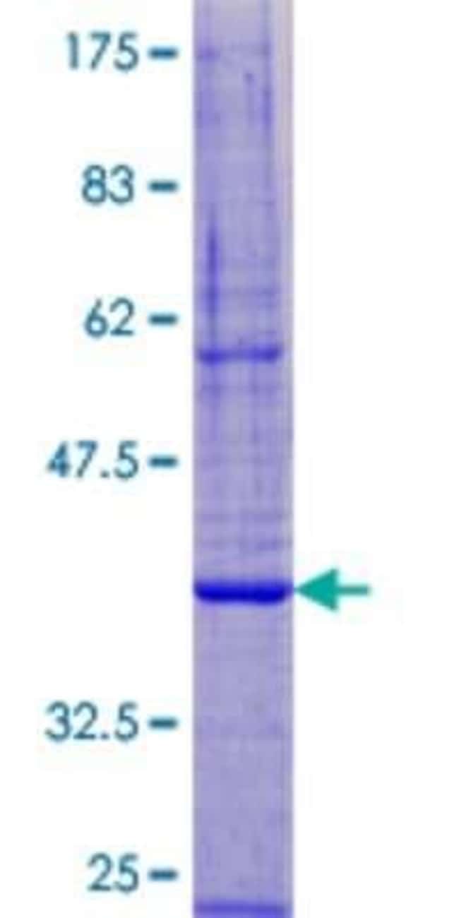 Novus Biologicals™ Recombinant Human DPM3 GST (N-Term) Protein 25 μg ...
