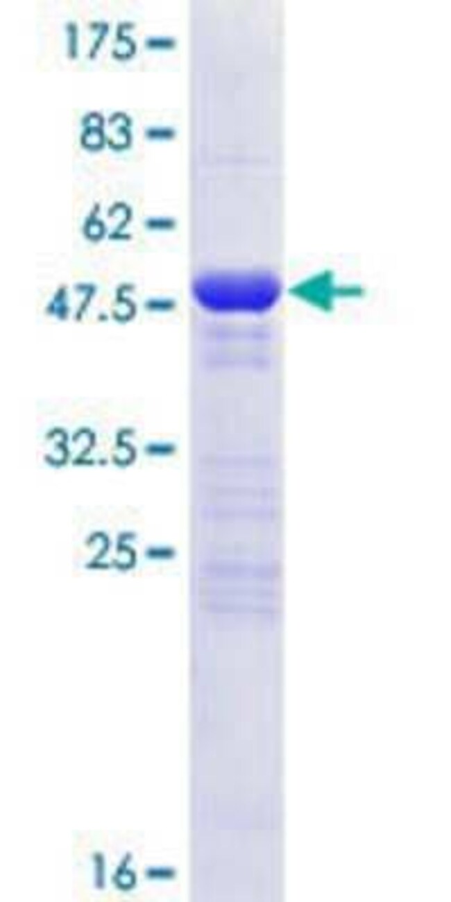 Novus Biologicals Recombinant Human RIAM/APBB1IP GST (N-Term) Protein ...