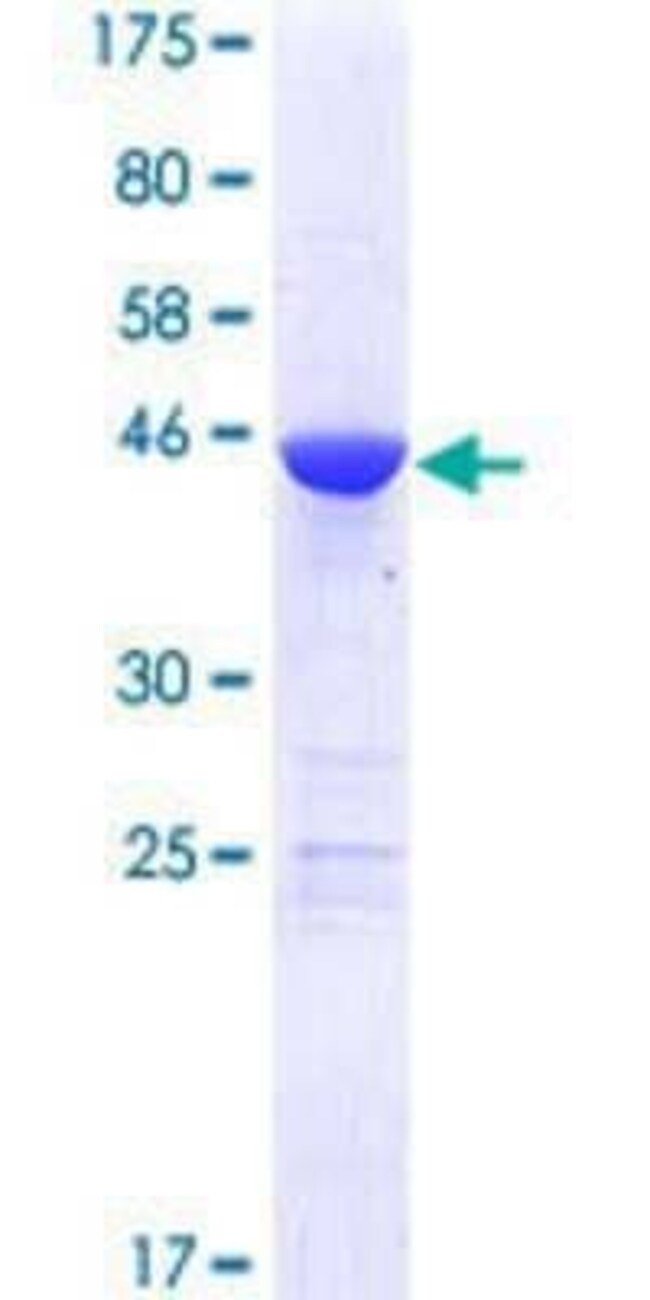Novus Biologicals Recombinant Human MED18 GST (N-Term) Protein 10 μg ...