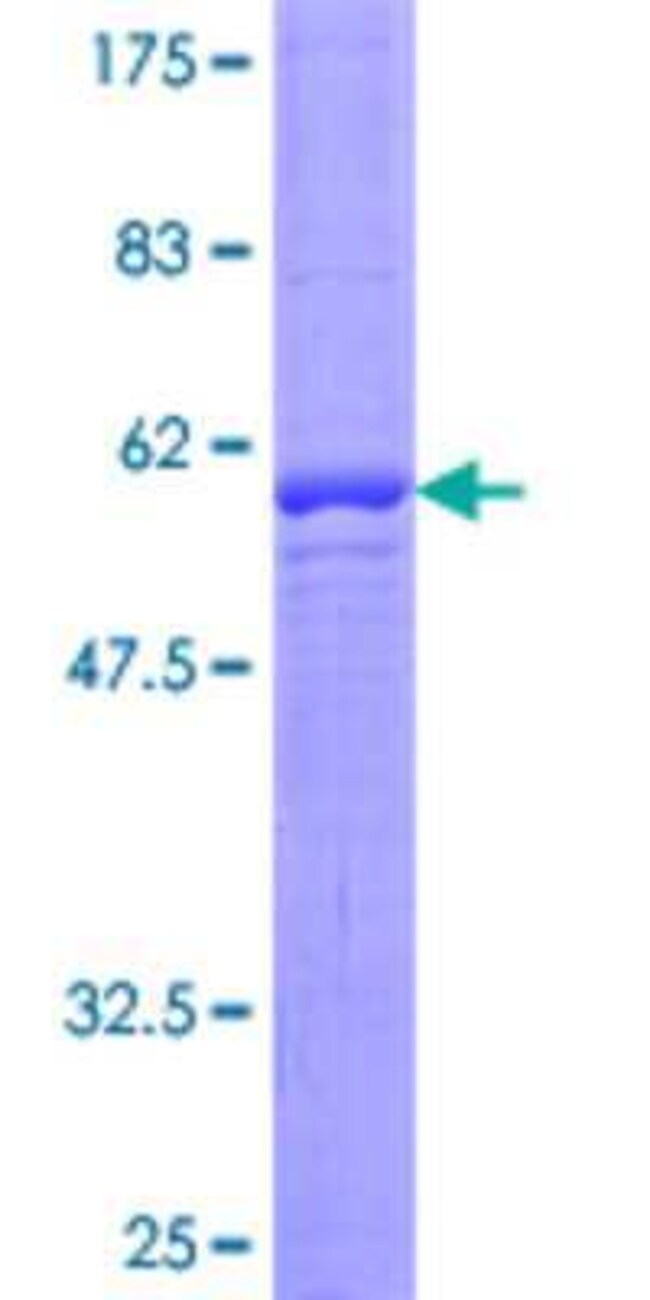 Novus Biologicals Recombinant Human RALGPS2 GST (N-Term) Protein 10 μg:Recombinant | Fisher ...