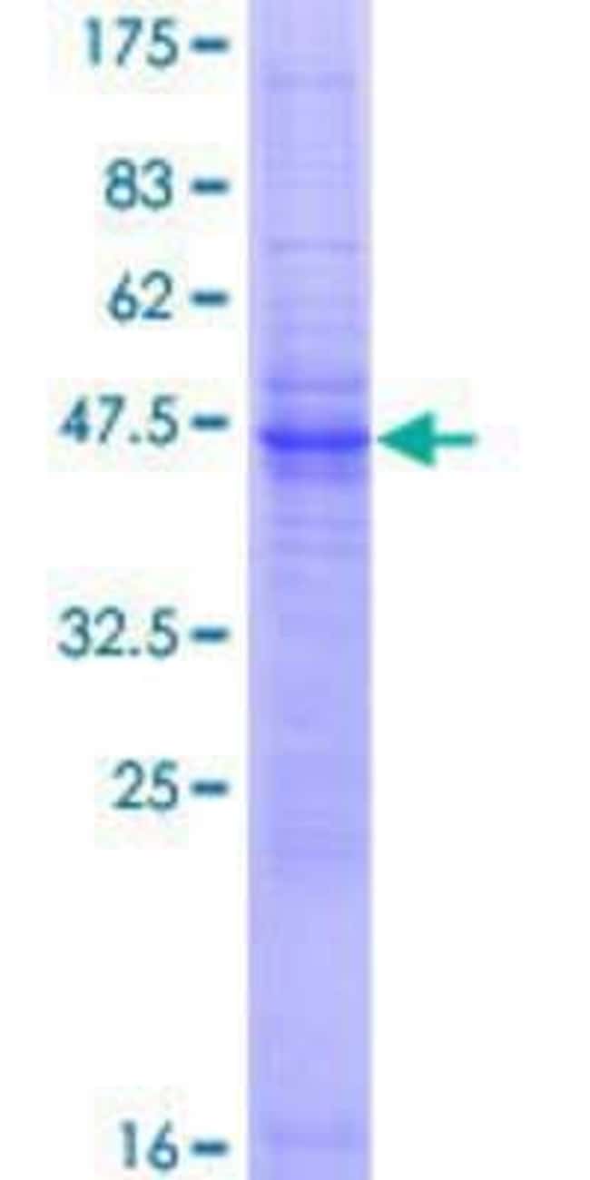 Novus Biologicals Recombinant Human TMEM9 GST (N-Term) Protein 25 μg ...
