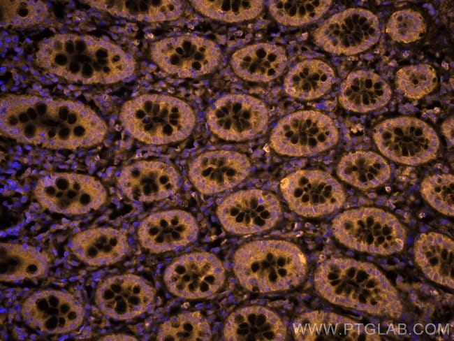 PPAR Gamma Mouse anti-Human, CoraLite 555, Clone: 4E12F10, Proteintech ...